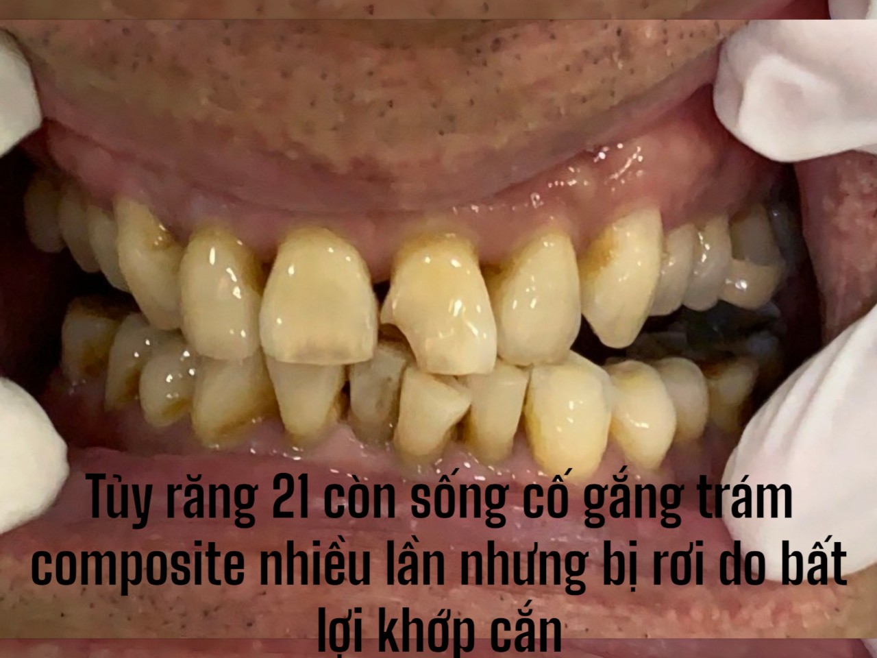 HƯỚNG DẪN SỬ DỤNG ZIRCOS-E - JELENKO VIỆT NAM